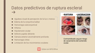 TRAUMA OCULAR EXPO ANGIE.pdf