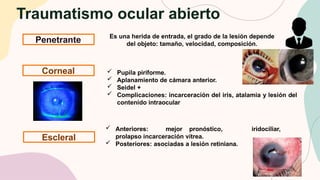 trauma ocular Marci.pptx traumatismo ocular | PPTX