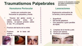 trauma ocular Marci.pptx traumatismo ocular | PPTX
