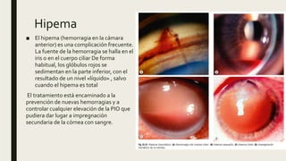 Trauma ocular MERY.pptx