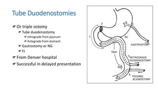 Trauma of duodenum | PPT