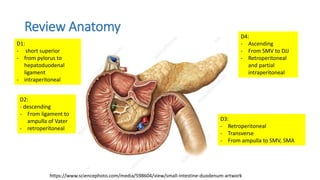 Trauma of duodenum | PPT