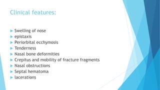 Trauma of nose.pptx
