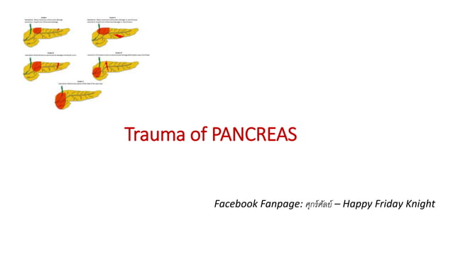 Trauma of PANCREAS | PPT