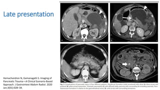 Trauma of PANCREAS | PPTX