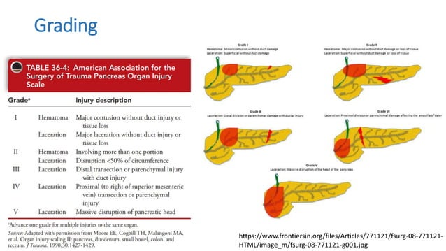 Trauma of PANCREAS | PPT