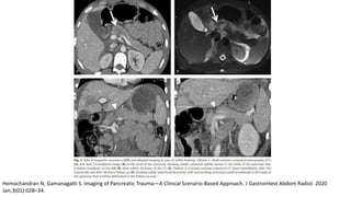 Trauma of PANCREAS | PPTX