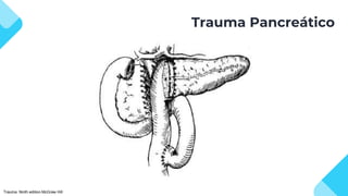 trauma de pancreas segun sociedad mundial | PPTX