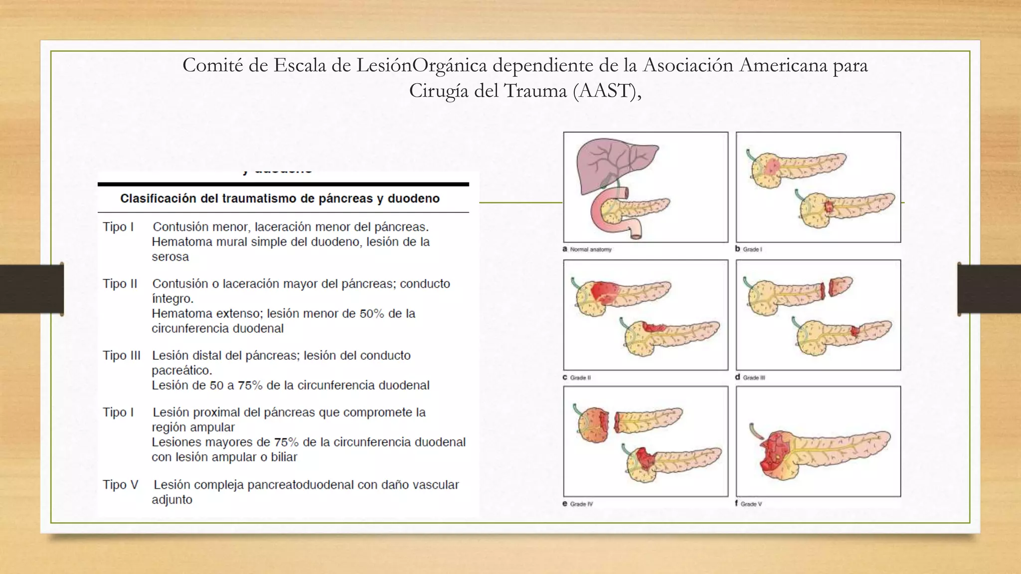 Trauma pancreatoduodenal | PPTX