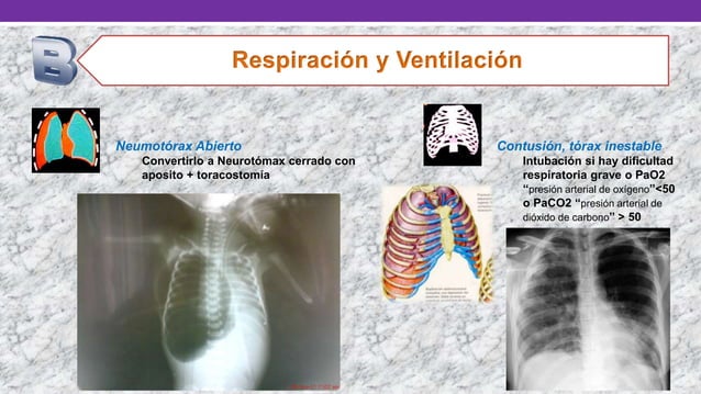 Trauma pediatrico | PPTX