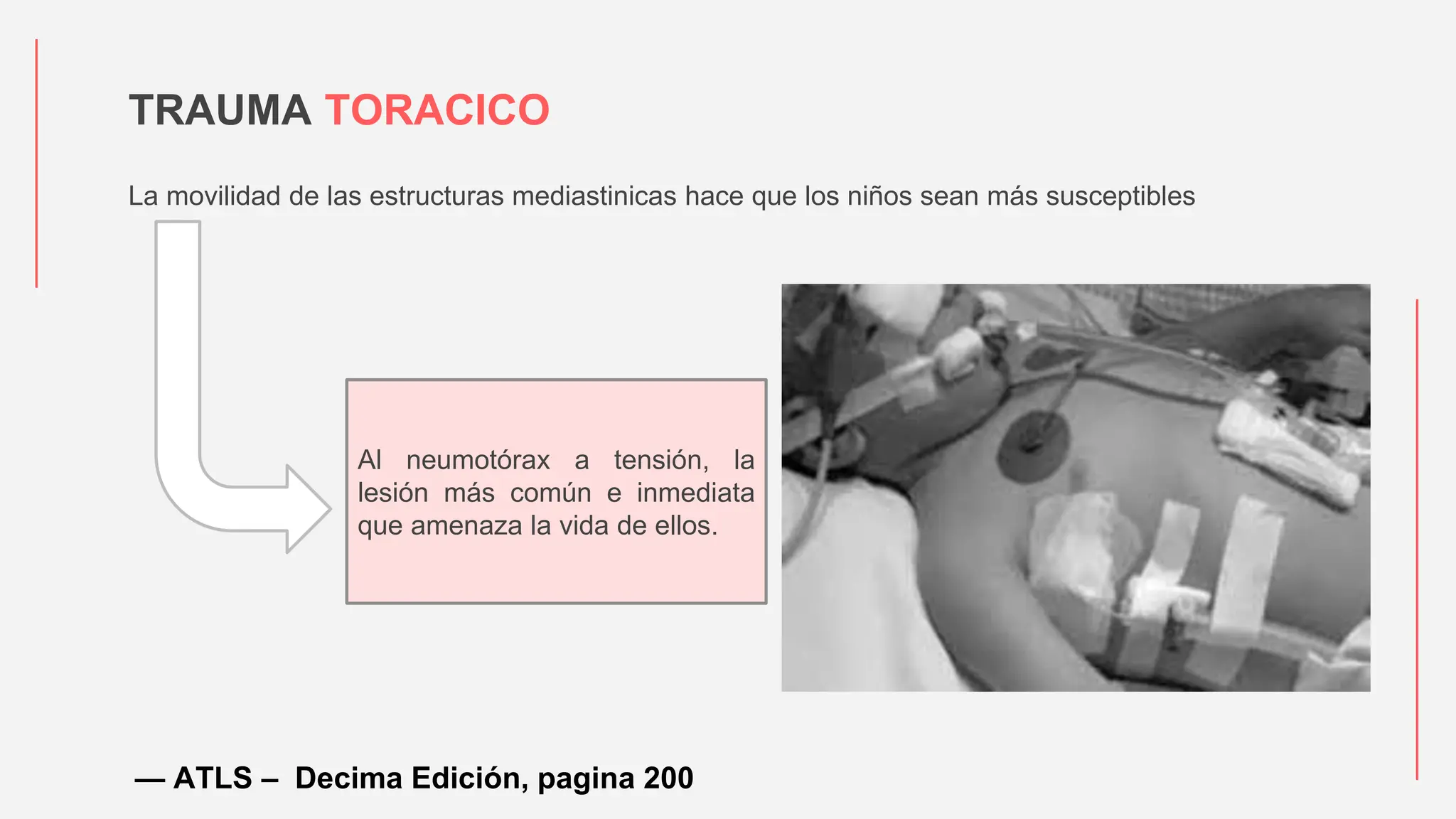 Trauma PEDIATRICO.pdftraumatilogia actualiza | PPT