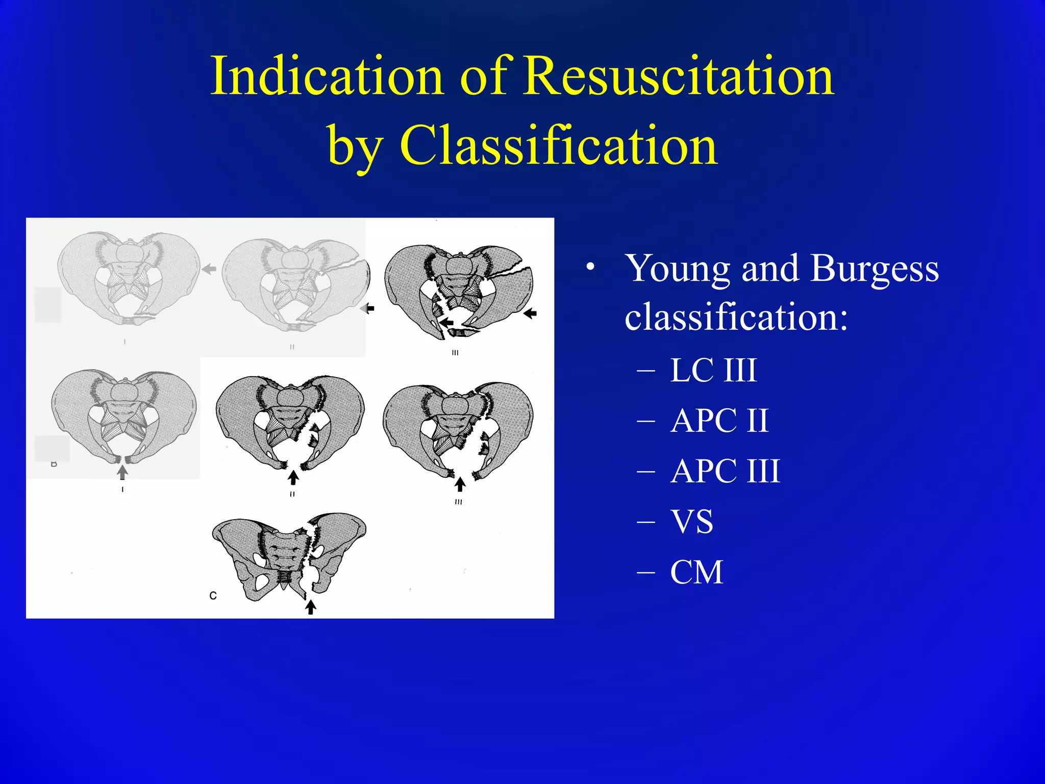 Trauma pelvic fracture ortho prespective | PPT
