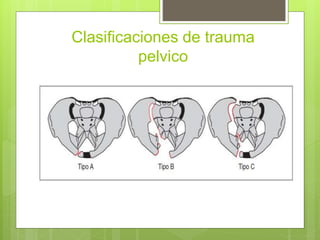 trauma pelvico.ppt