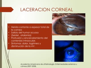 TRAUMA PENETRANTE.pptx.................. | PPTX