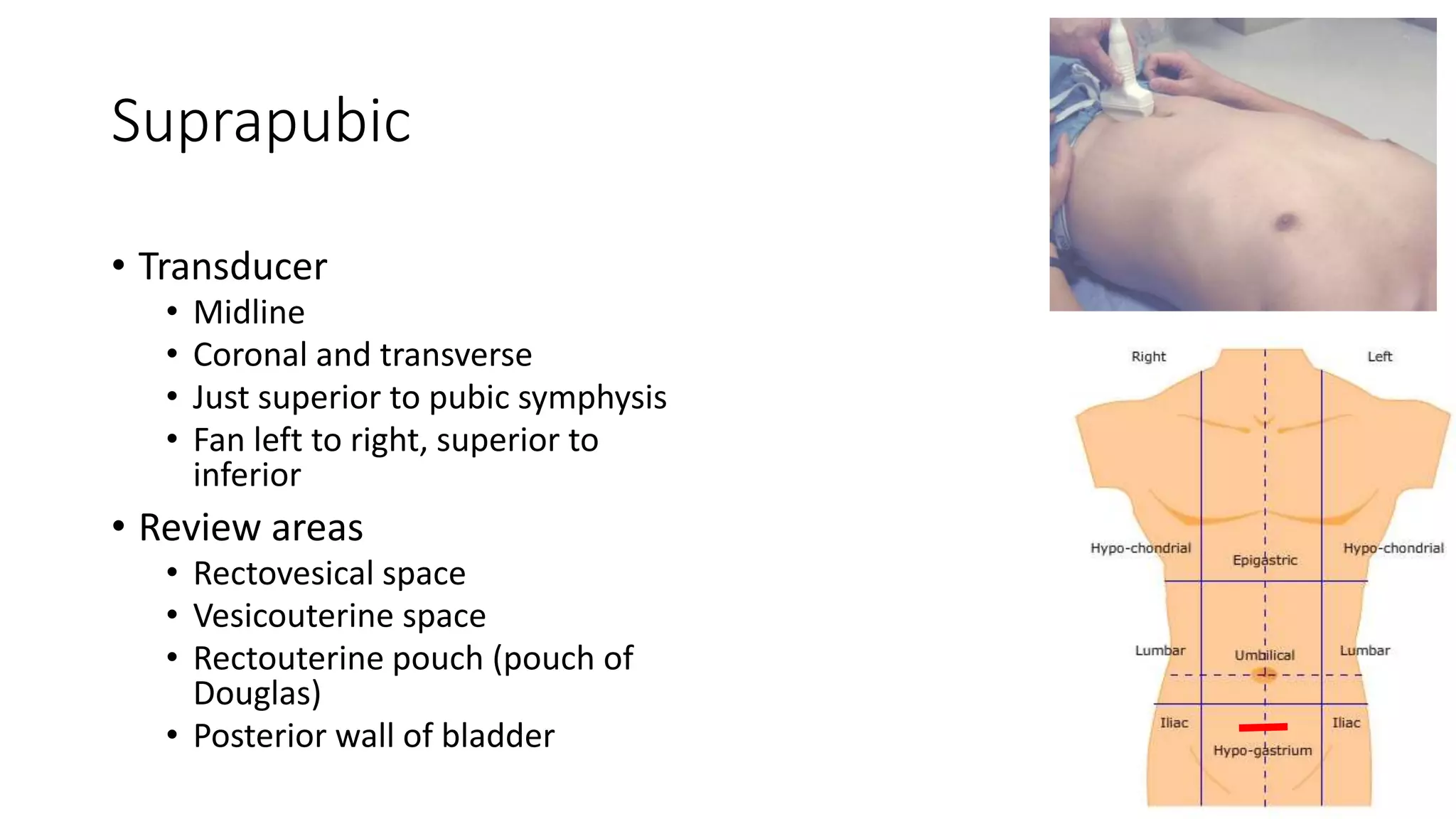 Trauma Ultrasound: What you need to know | PPTX