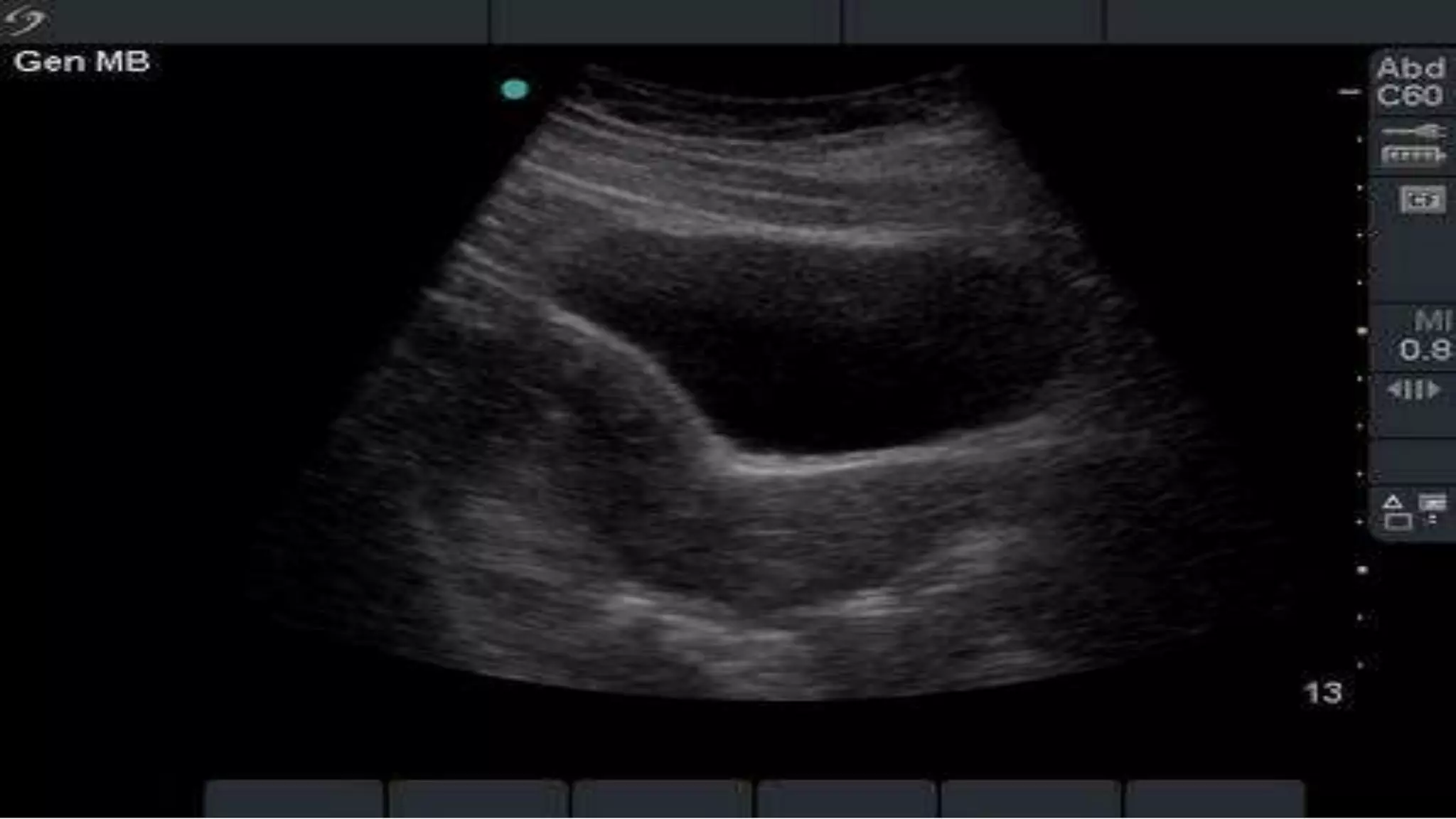 Trauma Ultrasound: What you need to know | PPTX
