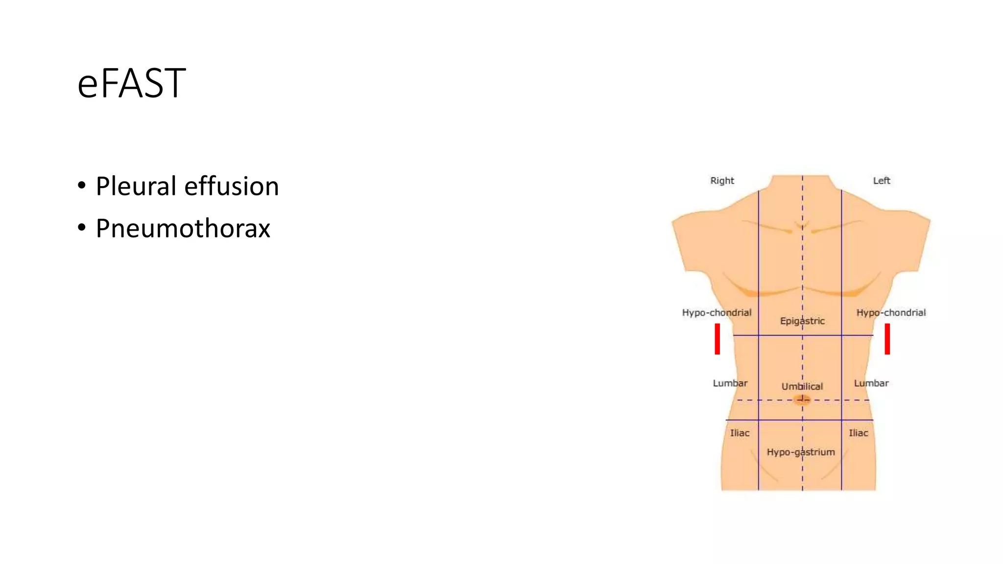 Trauma Ultrasound: What you need to know | PPTX