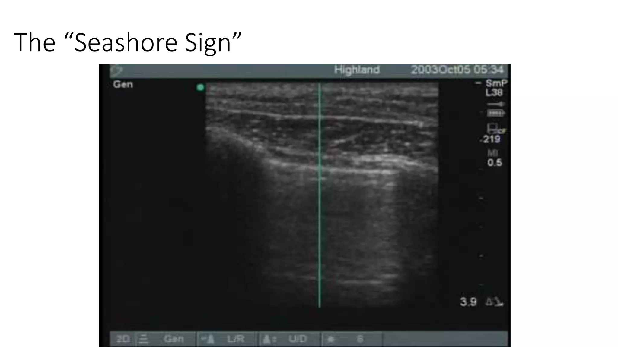 Trauma Ultrasound: What you need to know | PPTX