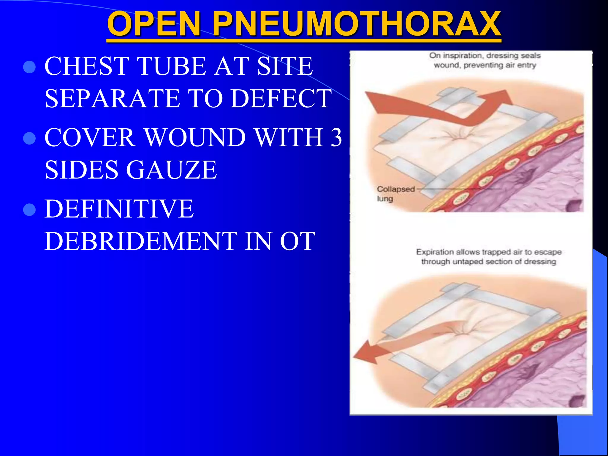INITIAL ASSESSMENT OF TRAUMA PATIENTS....(INSPIRED FROM CTLS AND ATLS ...