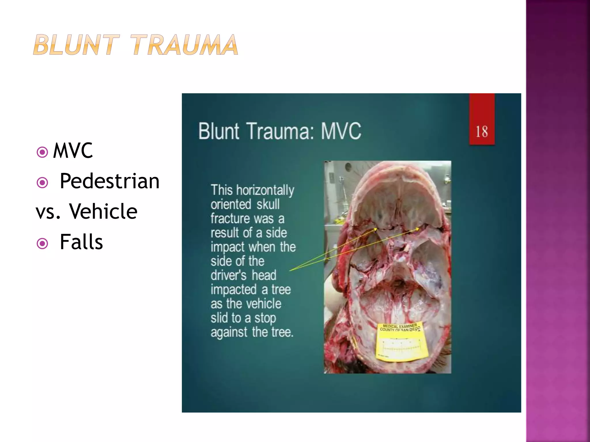 Trauma,mechanism,classification, pathophysiology, sign and symptoms ...