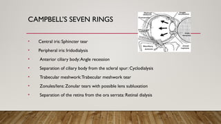 post traumatic glaucoma ( secondary glaucoma) | PPTX