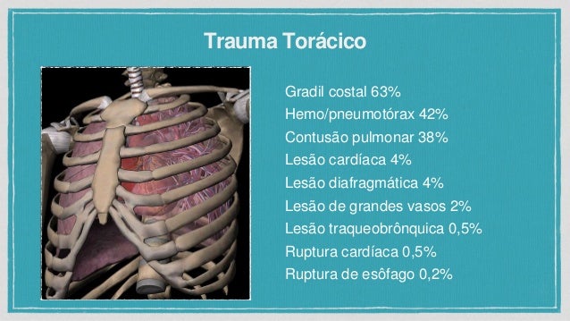 Trauma Toracico - LANCi