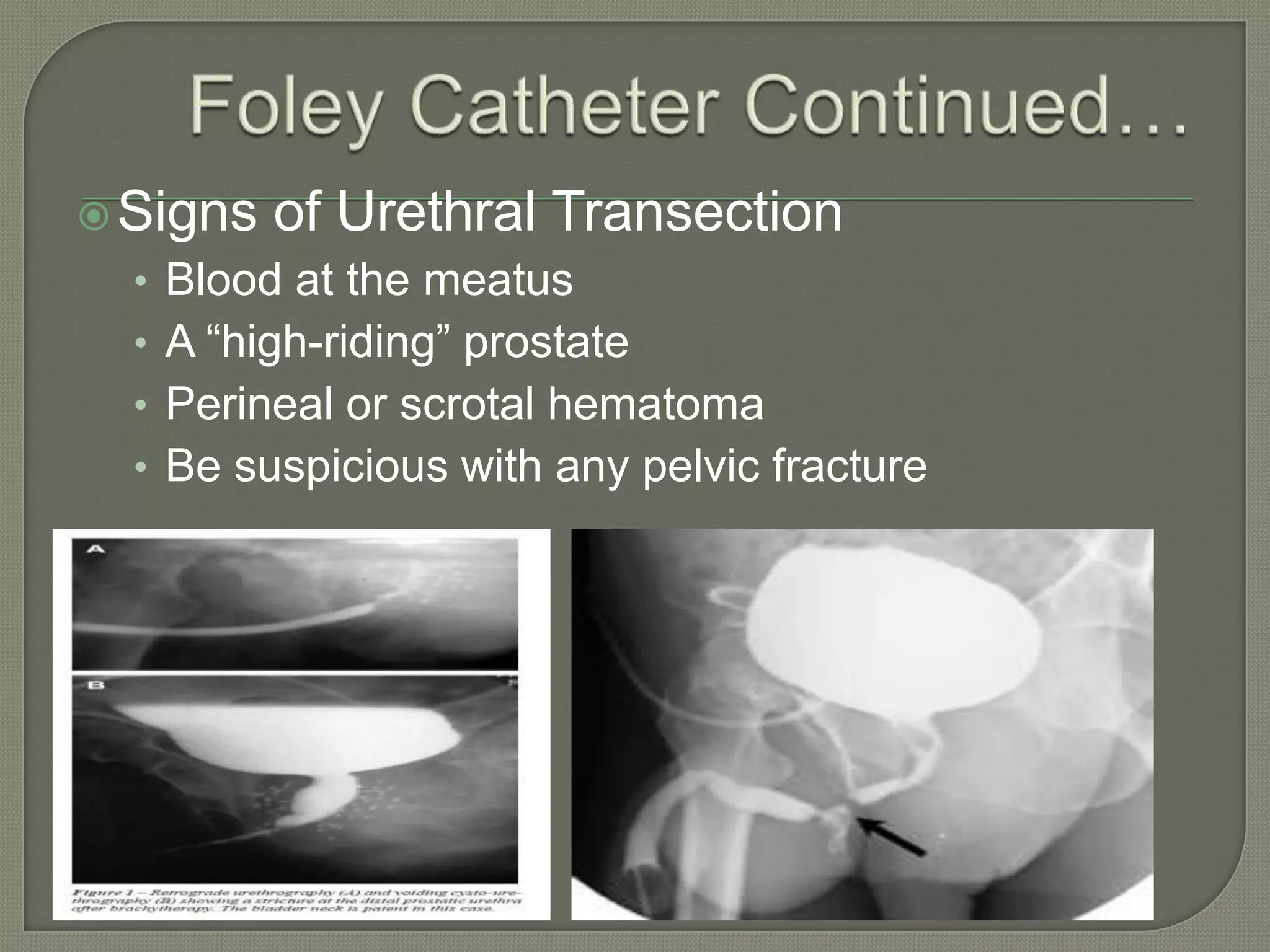 Trauma Presentation | PPTX