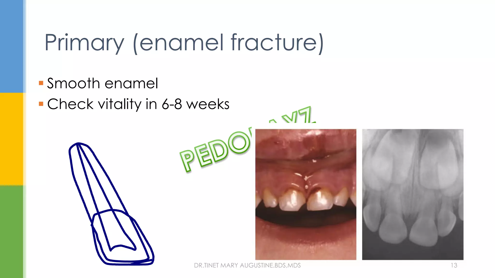 Traumatic injury to the primary dentition | PDF