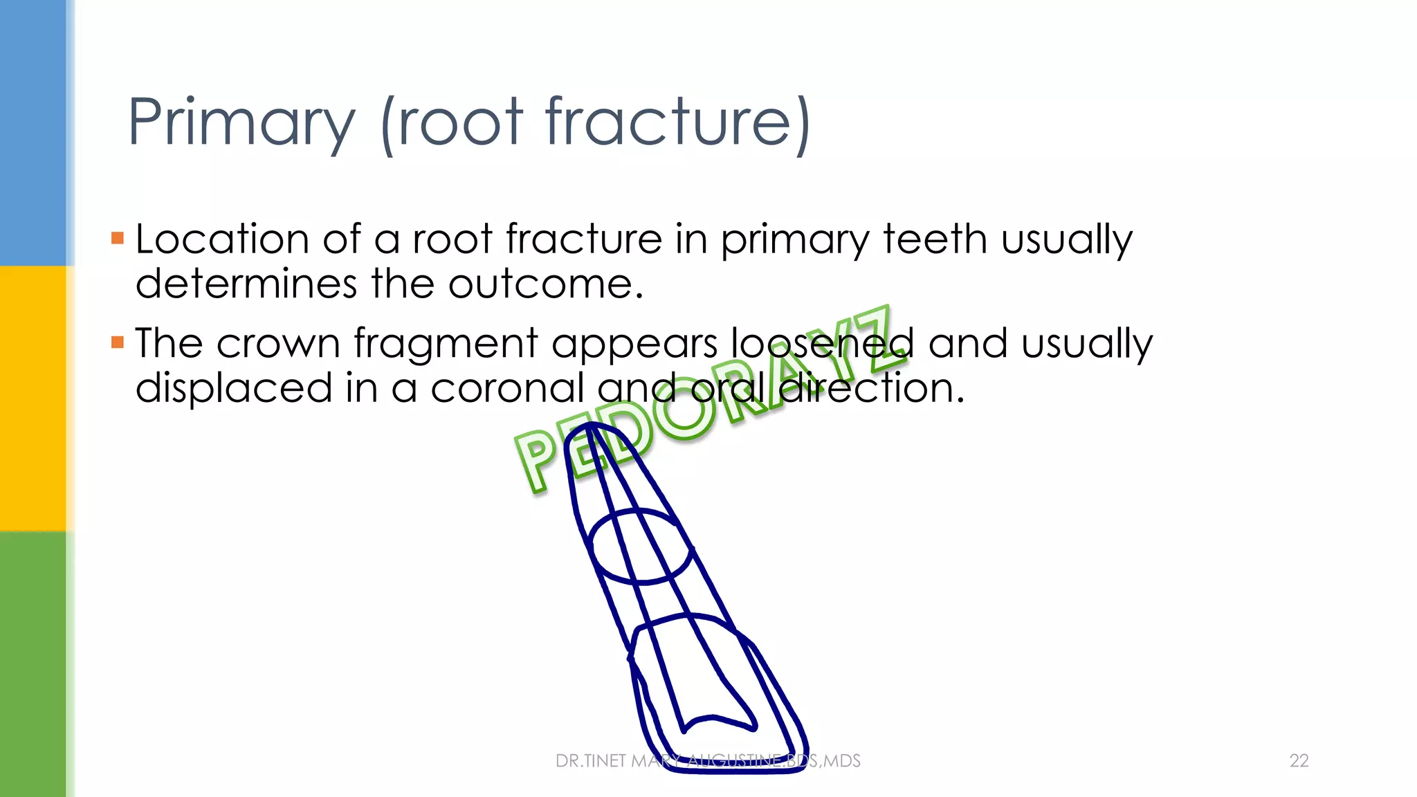 Traumatic injury to the primary dentition | PDF