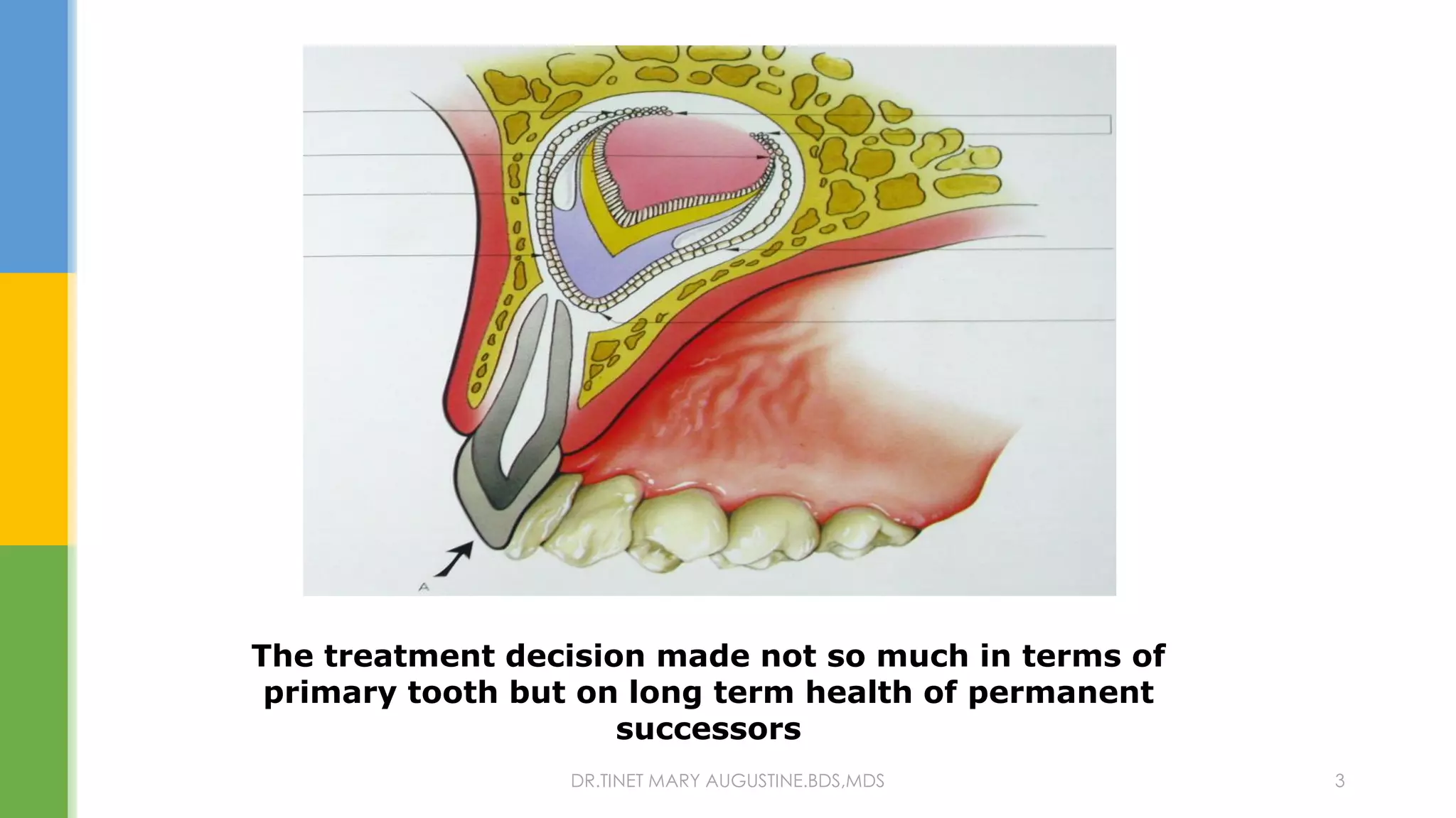 Traumatic injury to the primary dentition | PDF