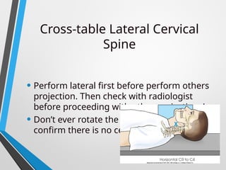 TRAUMA RADIOGRAPHY MEDICAL IMAGING STUDY.ppt