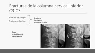 Trauma Raquimedular En La Clinica De Neurologia pptx trauma-raquimedular-en-la-clinica-de-neurologia-pptx