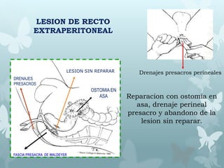 Trauma rectal | PPTX