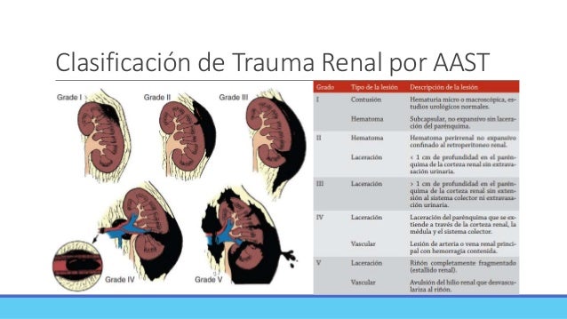 Trauma renal