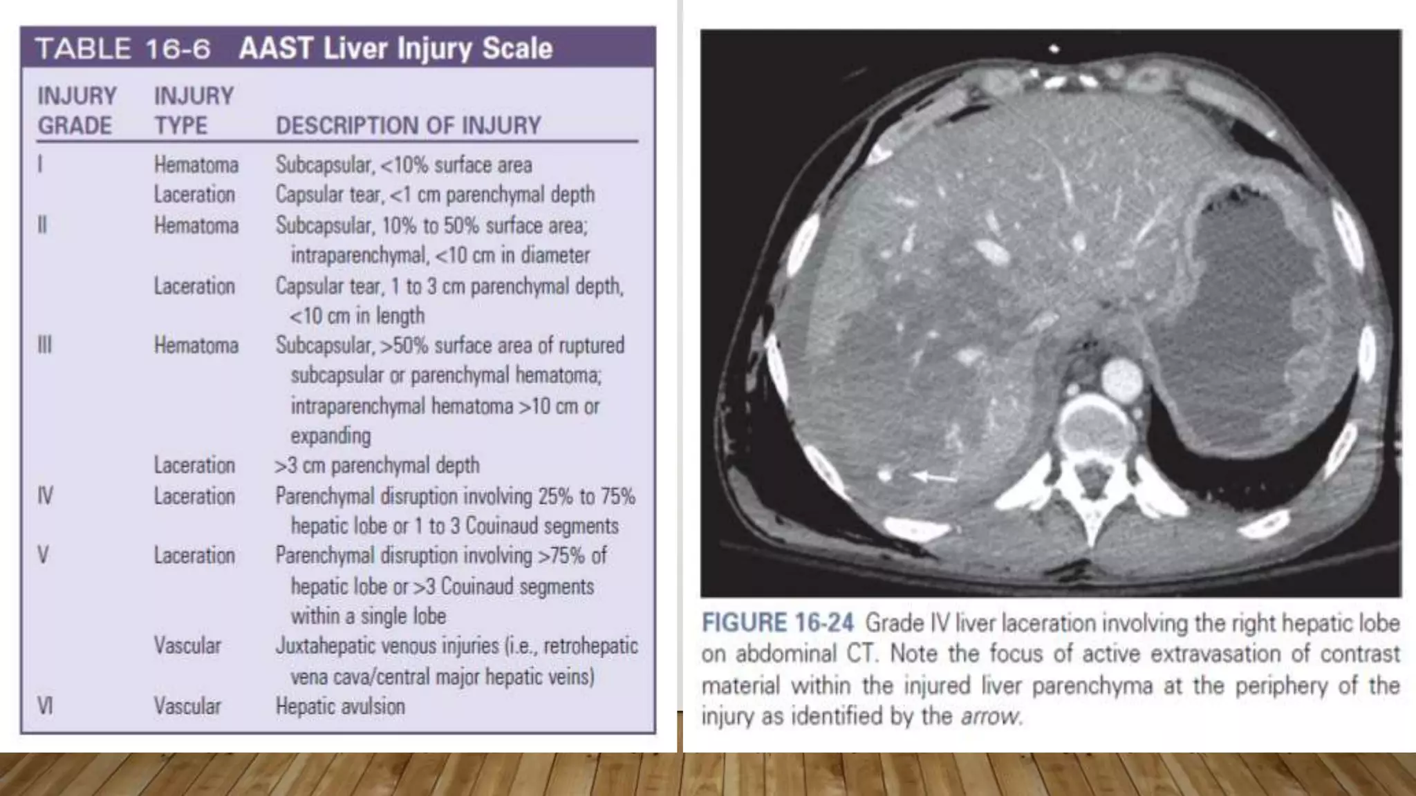 Trauma scoring systems | PPTX
