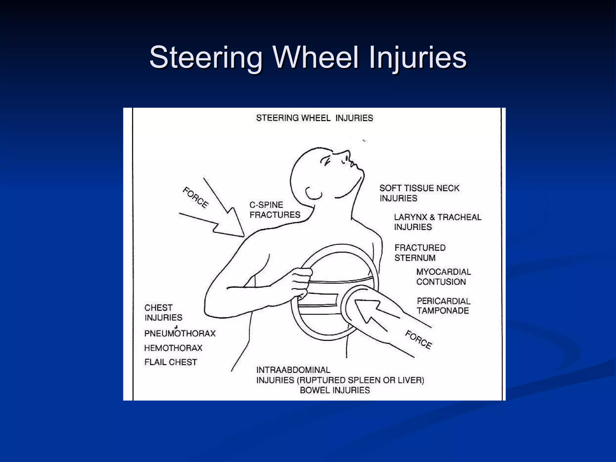 Trauma and mechanism of injuries | PPT