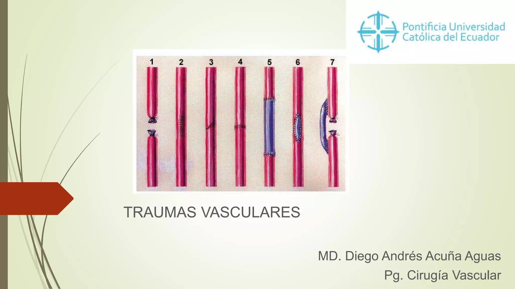 Trauma vascular | PPT