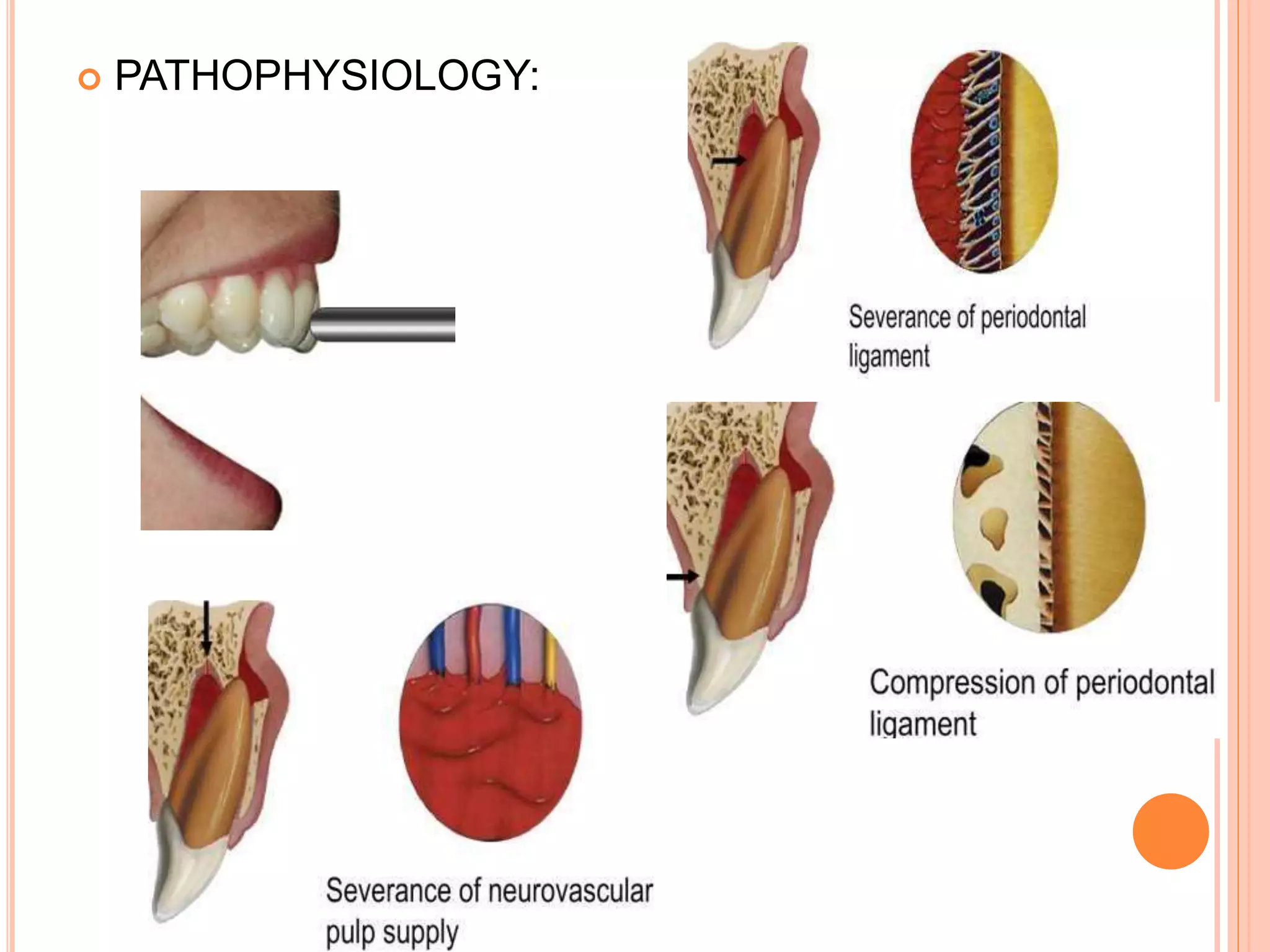 Traumatic injuries in pediatric dentistry | PPTX