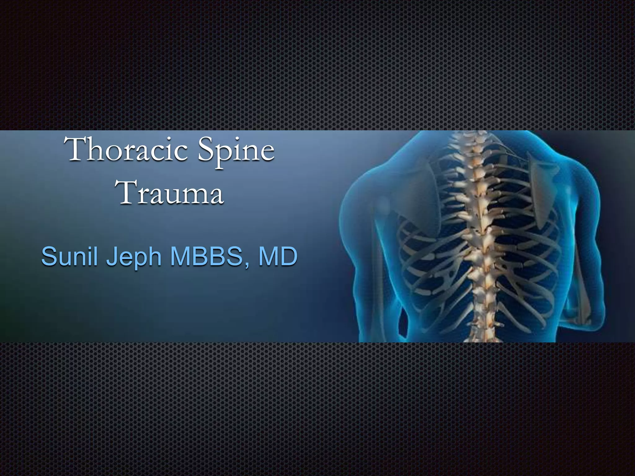 Imaging of thoracic spine Trauma | PPTX