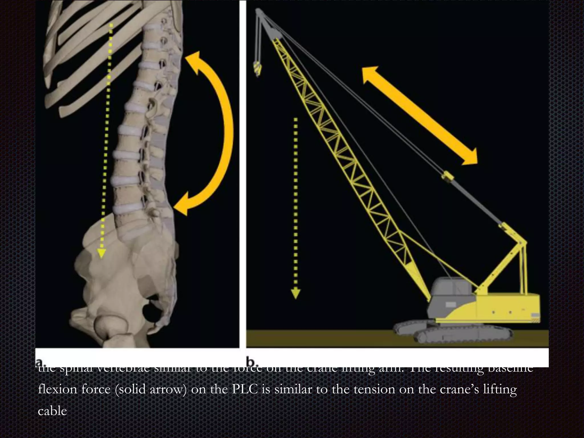 Imaging of thoracic spine Trauma | PPTX