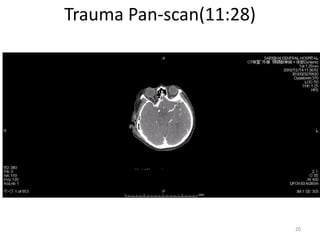 Trauma survey and intervention | PPTX