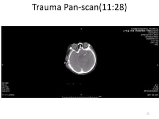 Trauma survey and intervention | PPTX