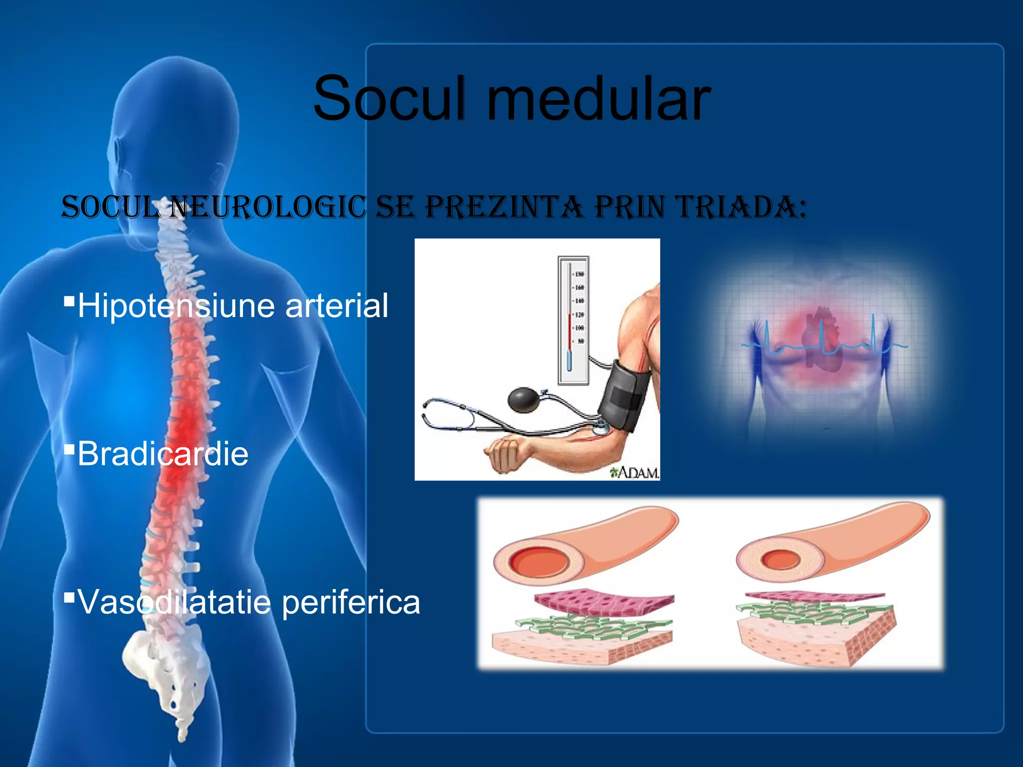 Traumat.vertebro medulare | PPT