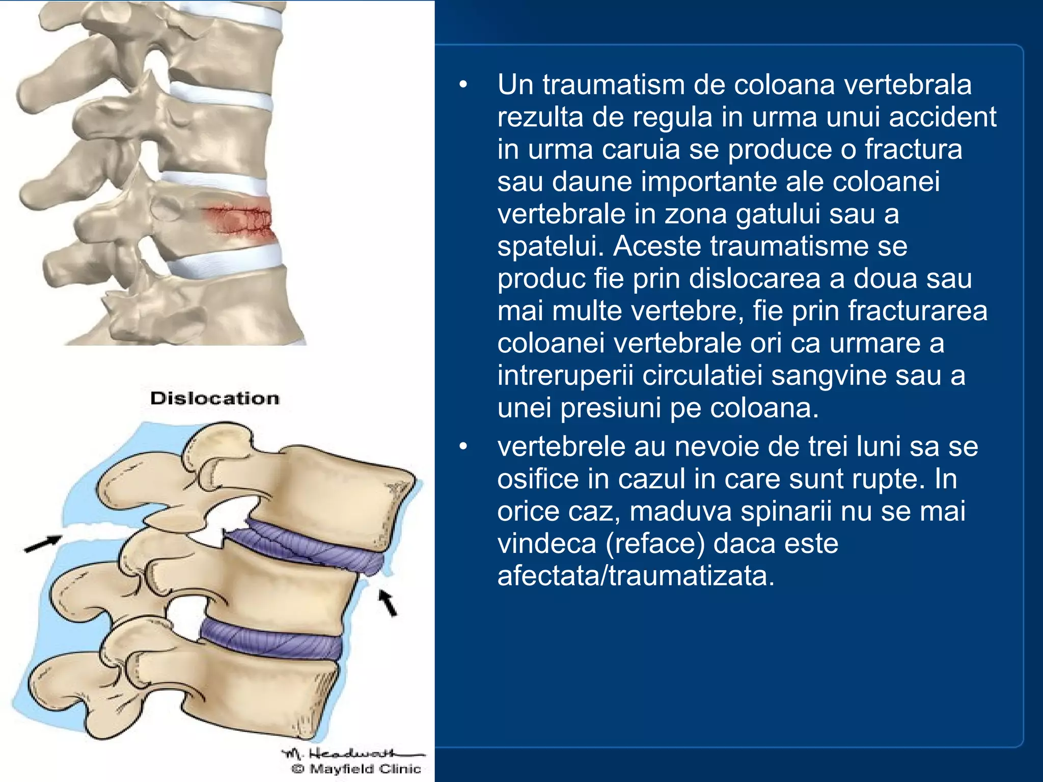 Traumat.vertebro medulare | PPT