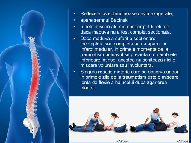 Traumat.vertebro medulare | PPT