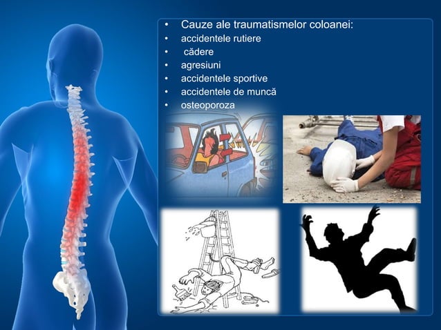 Traumat.vertebro medulare | PPT
