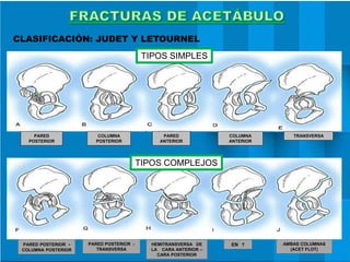 TRAUMATo fractura de caderannnnnnnnn.pptx