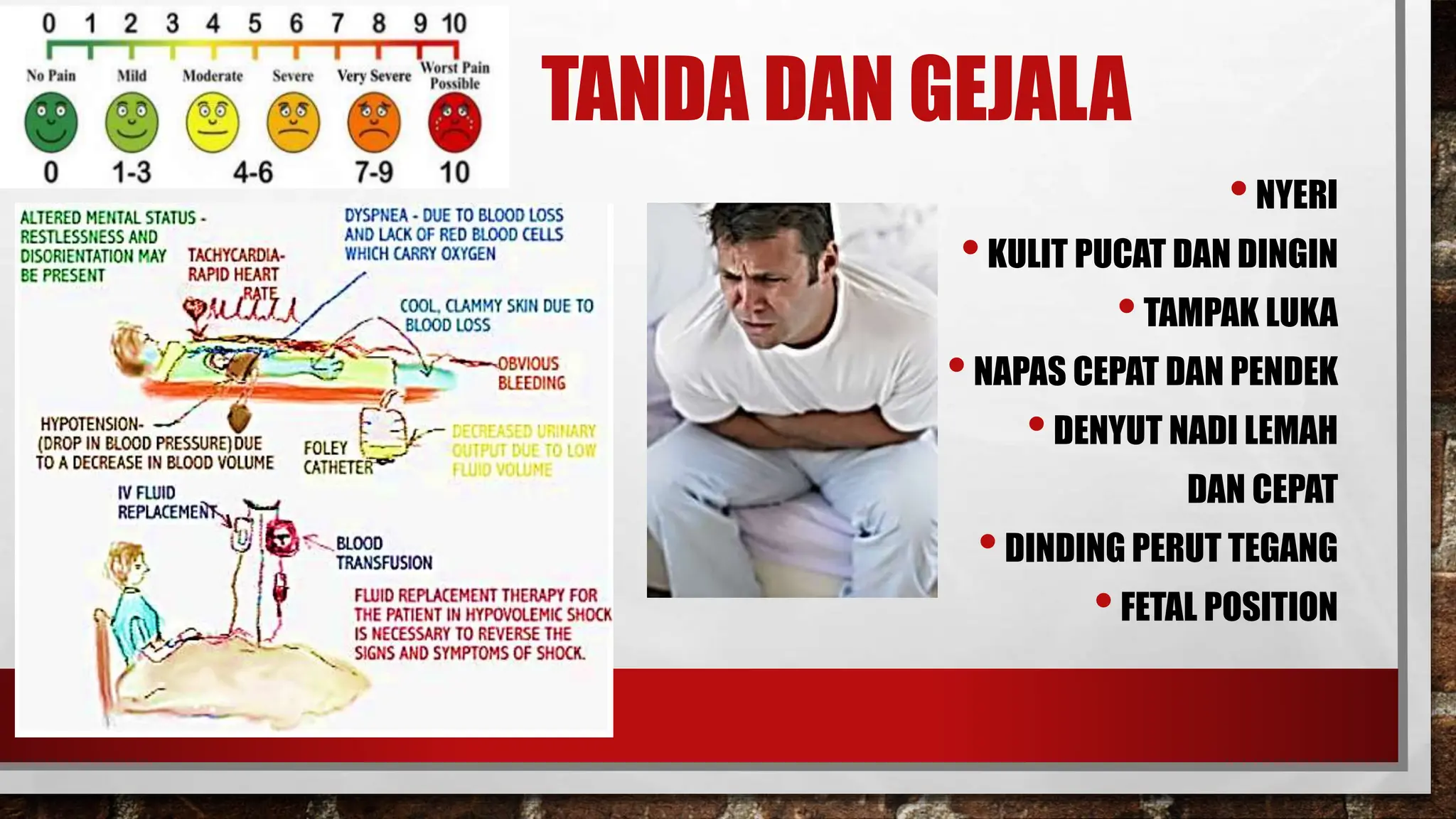 Trauma tajam abdomen dan penanganannya.pptx
