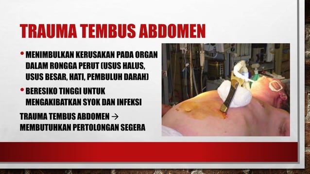 Trauma tajam abdomen dan penanganannya.pptx