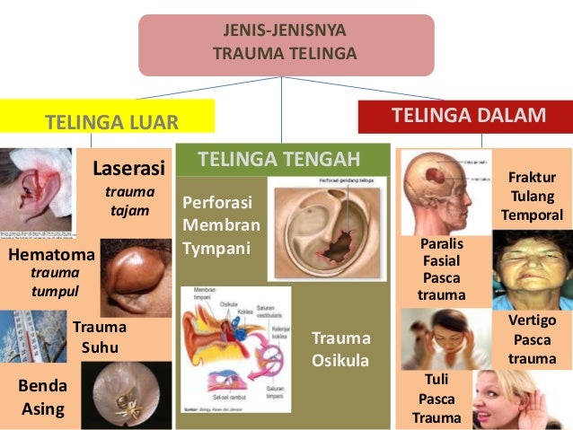TRAUMA TELINGA (Ear Trauma)